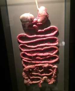 Worlds intestines - Back in Action