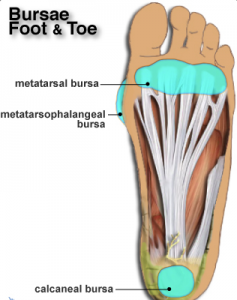 Bursitis in the Foot - Back in Action Physio Injury Information